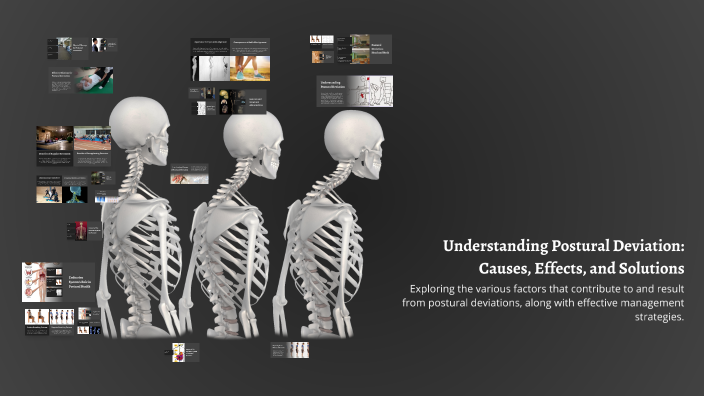 Understanding Postural Deviation: Causes, Effects, and Solutions by ...