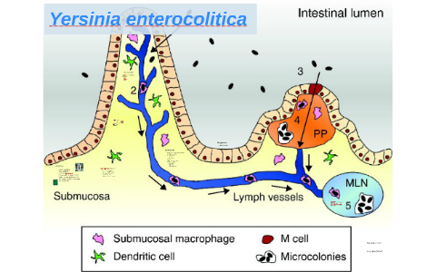 Yersinia enterocolitica by Megan Couture on Prezi