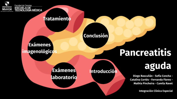 Pancreatitis aguda by Camila Ravet on Prezi