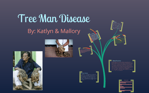 Tree Man Disease by Mallory Wolford on Prezi