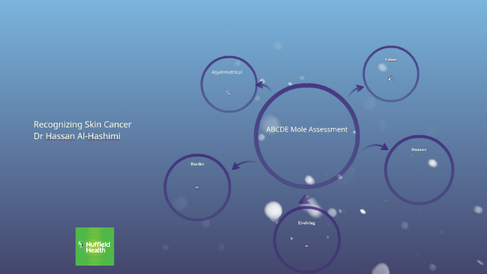 ABCDE Mole Assessment by hassan AL on Prezi