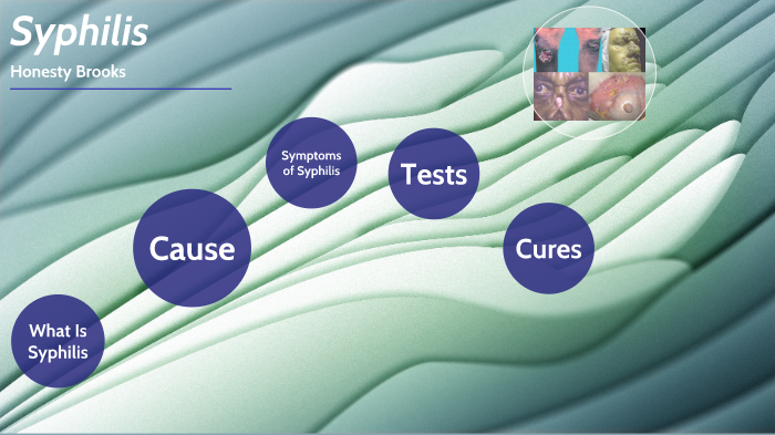Syphilis Project by keierra brooks on Prezi