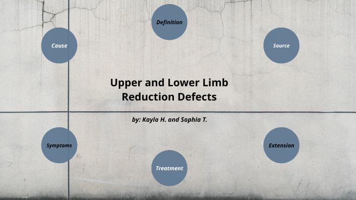 Upper and Lower Limb Reduction Defects by Sophia Tamaris on Prezi