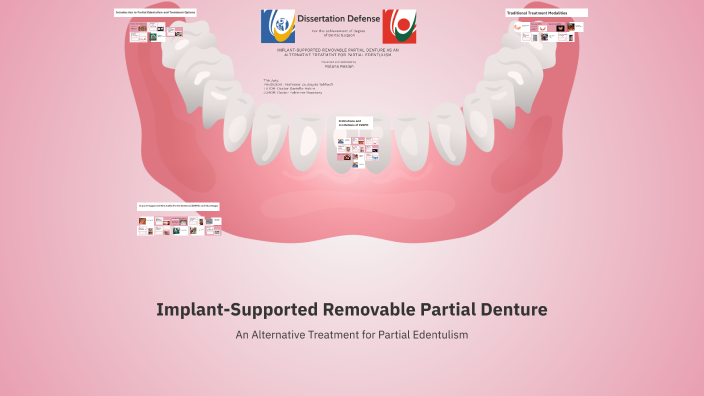 Implant-Supported Removable Partial Denture by dentistry 3eme on Prezi