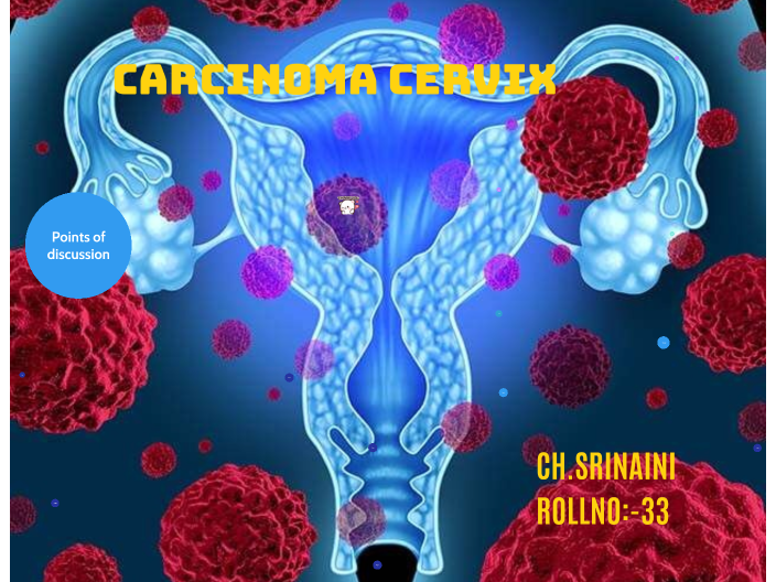 carcinoma cervix by 33 Srinaini Ch on Prezi