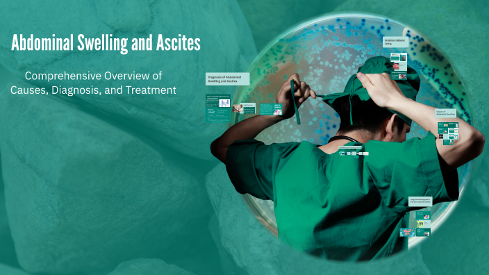 Abdominal Swelling and Ascites by sam Joseph on Prezi