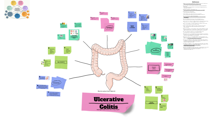Ulcerative Colitis by Noah Flores on Prezi