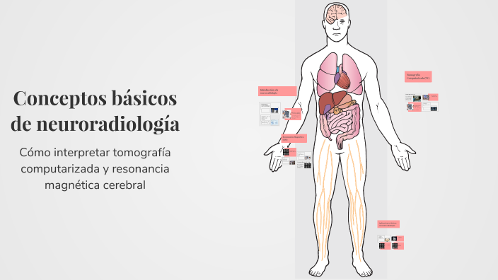 Conceptos básicos de neuroradiología by Angelo Queirolo on Prezi