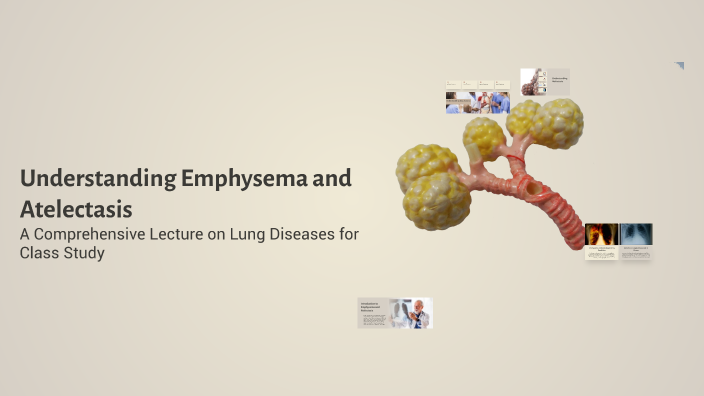Understanding Emphysema and Atelectasis by zozk kama on Prezi