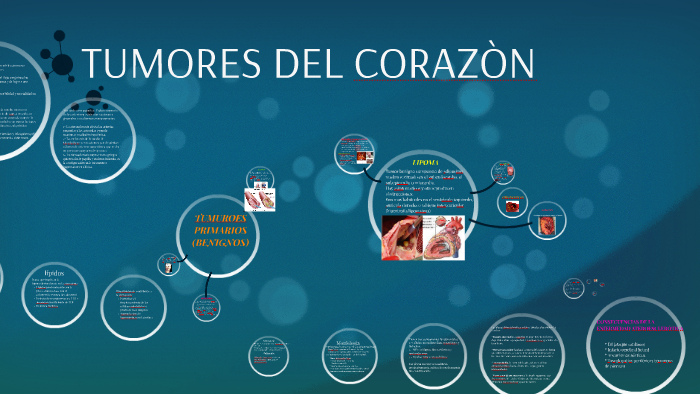 TUMORES DEL CORAZÒN by
