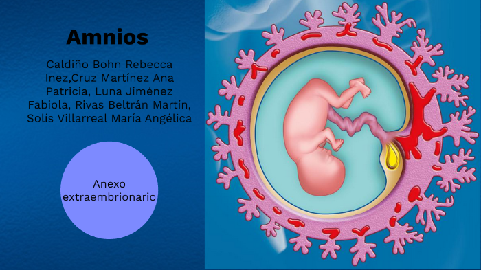 Amnios by Ailanie Luna on Prezi