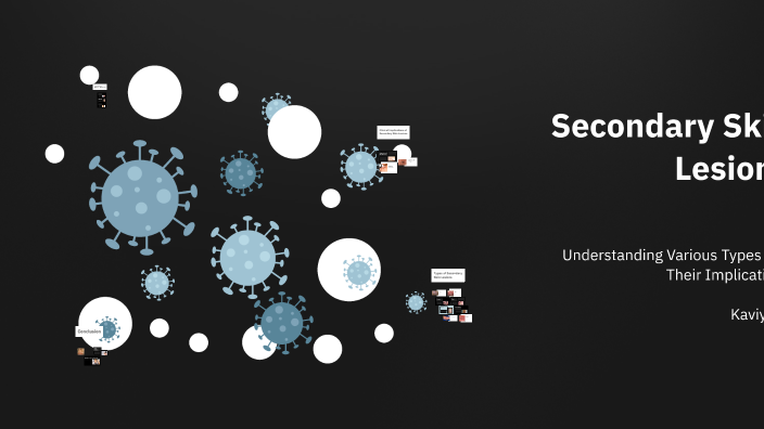Secondary Skin Lesions in Dermatology by Kaviya Mohanraj on Prezi