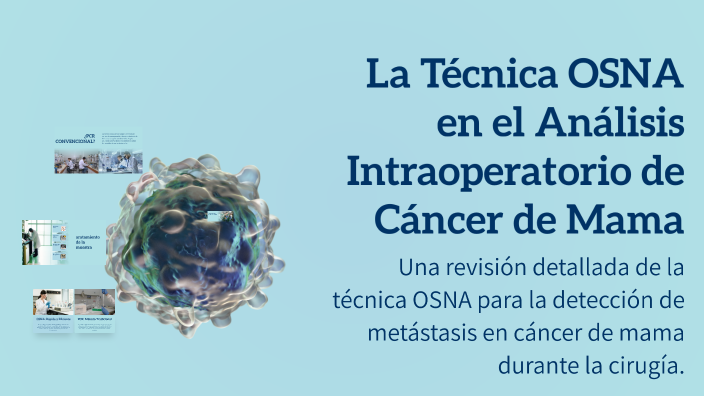 La Técnica OSNA en el Análisis Intraoperatorio de Cáncer de Mama by ...