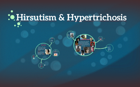 Hirsutism & Hypertrichosis by Arie Roth