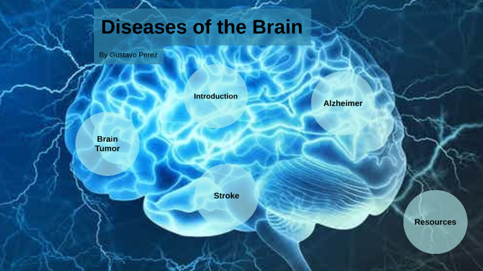 Diseases of the brain by Gustavo Perez on Prezi