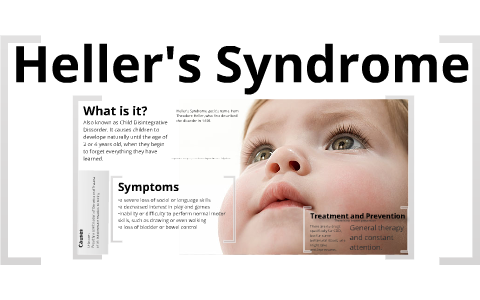 Heller's Syndrome by Alayna Bone on Prezi