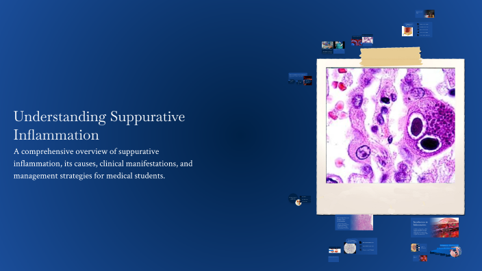 Understanding Suppurative Inflammation by mostafa 3bbud on Prezi