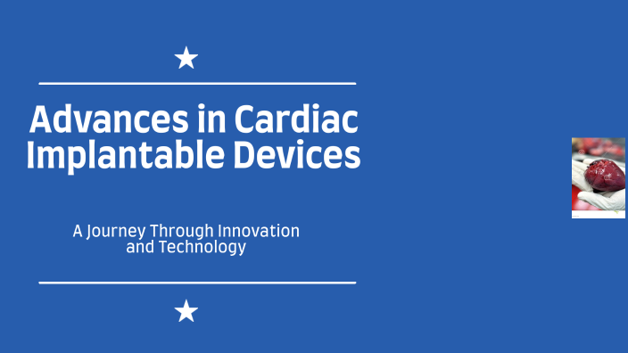 Advances in Cardiac Implantable Devices by kannan ramanathan on Prezi