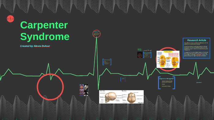 Carpenter Syndrome by Lexi Dufour on Prezi