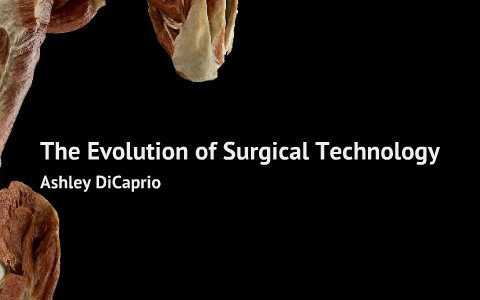The Evolution of Surgical Technology by Ashley DiCaprio on Prezi
