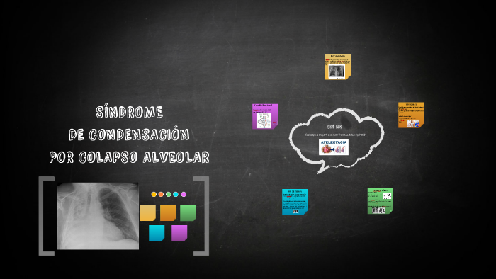 SÍNDROME DE CONDENSACIÓN POR COLAPSO ALVEOLAR by celeste rodas on Prezi