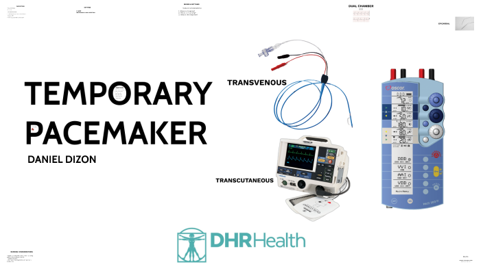 Temporary Pacemaker by Daniel Dizon on Prezi