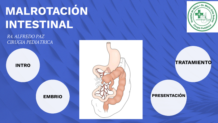 malrotacion intestinal by alfredo paz on Prezi