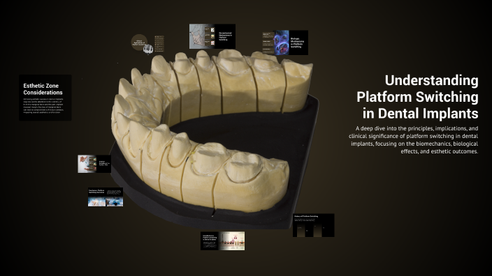 Understanding Platform Switching in Dental Implants by hamed rabbani on ...