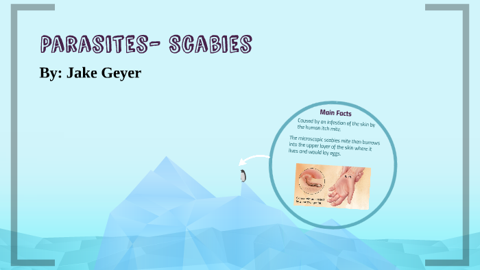 Parasites- Scabies by Jake Geyer on Prezi