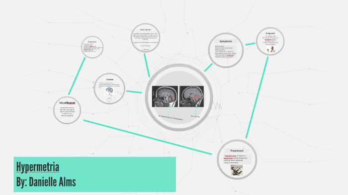 Hypermetria by Danielle Mae on Prezi