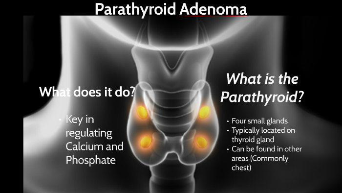 What is the Parathyroid? by Zachary King