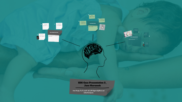 EEG Case Study: 5-Month-Old with Hypsarrhythmia by chinyere kurumeh on ...