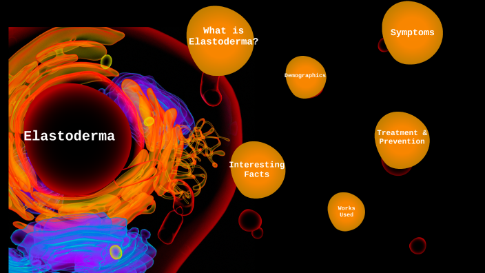 Elastoderma Presentation By Yulissa Cabrera On Prezi
