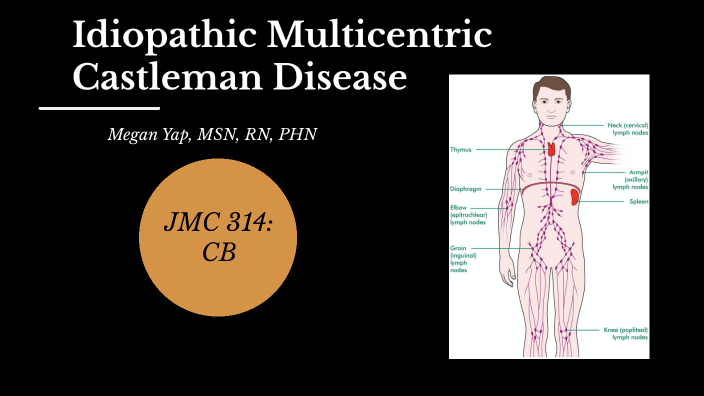 Castleman's Disease by Megan Yap on Prezi