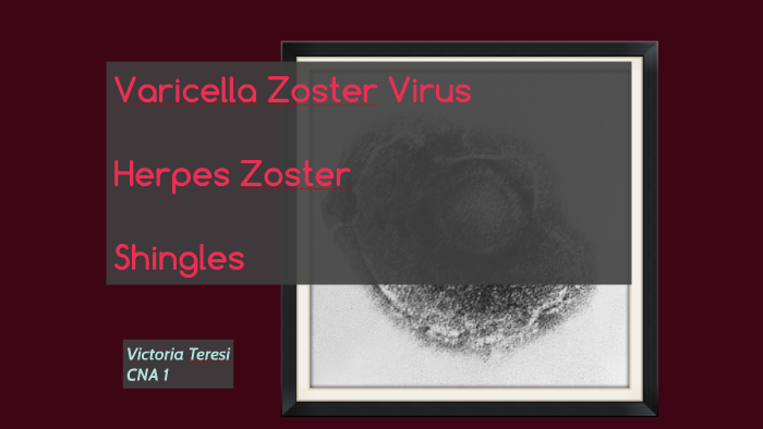 Varicella Zoster Virus by Victoria Teresi on Prezi
