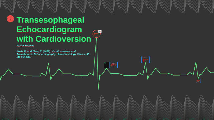 Transesophageal Echocardiogram with Cardioversion by Taylor Thomas on Prezi