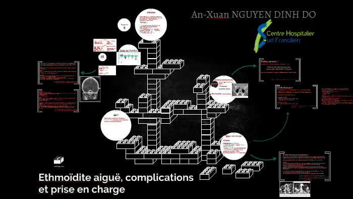 Ethmoïdite aiguë, complications et prise en charge by An Xuan Nguyen on ...