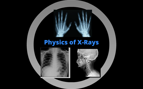 Physics of X-Rays by Bailey Johnson on Prezi