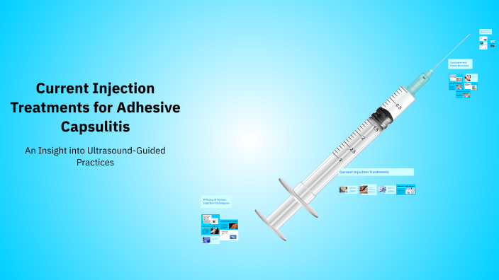 Current Injection Treatments for Adhesive Capsulitis by Laurence Roy ...