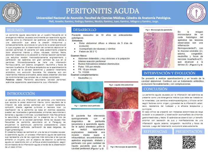 Peritonitis aguda by Plett Ratzlaff, Annelie Doreen on Prezi