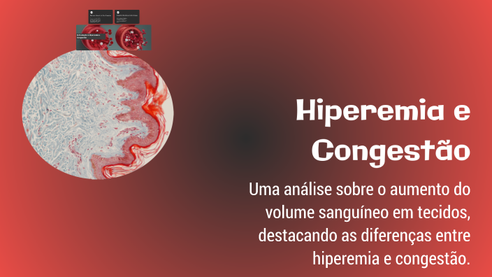 Hiperemia e Congestão by Marcelo Araujo on Prezi