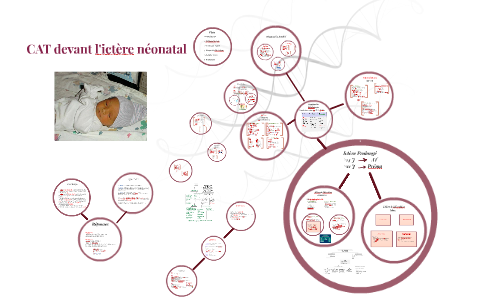CAT devant ictère néonatal by Farah Marraha on Prezi