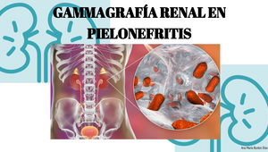 Gammagrafía renal en pielonefritis by Ana Bustos Díaz on Prezi Design