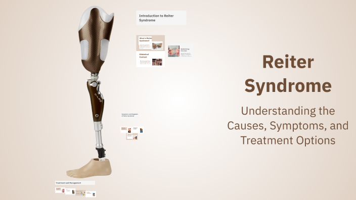 Reiter Syndrome by Ghada kamal on Prezi