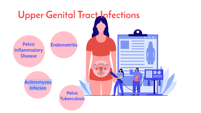 Upper Genital Tract Infection by Christian Panes on Prezi