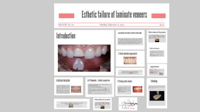 Esthetic failure of laminate veneers by Eslam Wesam on Prezi