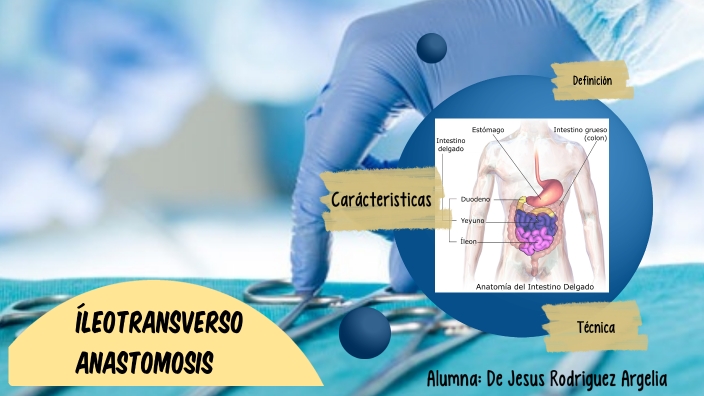 ileo transverso anastomosis by Argelia De Jesús on Prezi