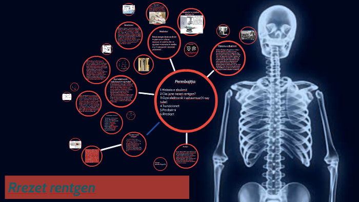 Rrezet rentgen by Jeta Dallku on Prezi
