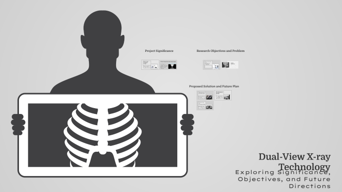Dual-View X-ray by Amine GUEZRI on Prezi