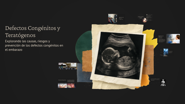 Defectos Congénitos y Teratógenos by JUAN DANIEL COYOTLA RIVERA on Prezi